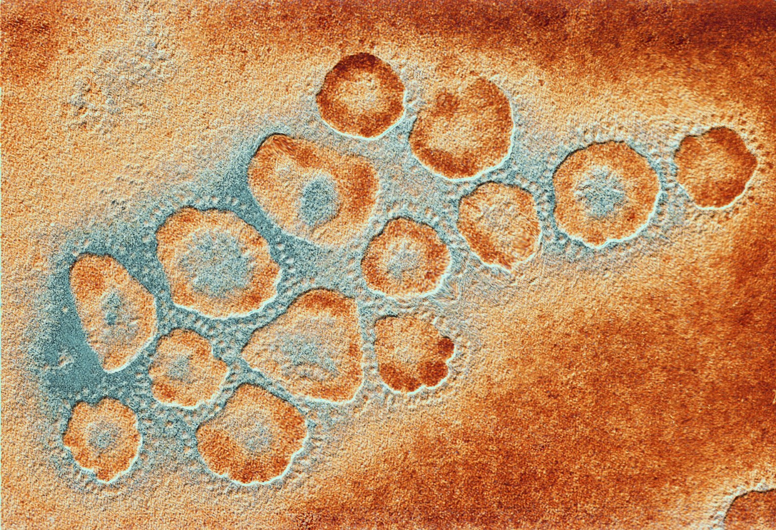 Virus Hunting Risks Triggering the Next Pandemic